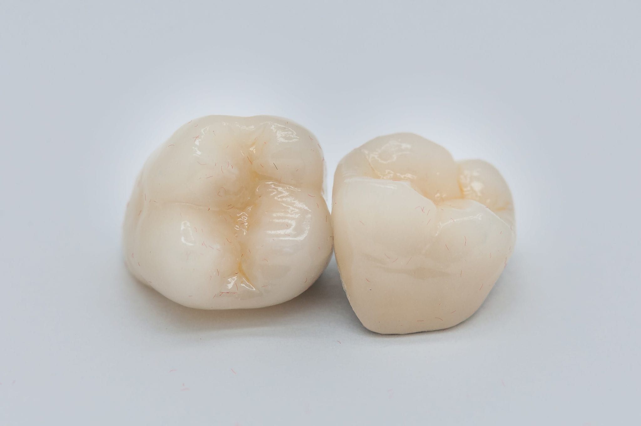 What Is A Zirconia Crown? » Santa Ana, CA - Sunset Dental Group
